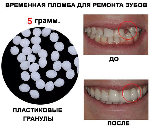 Стоматологическая пластмасса, материал: Пластик - купить с доставкой по ...