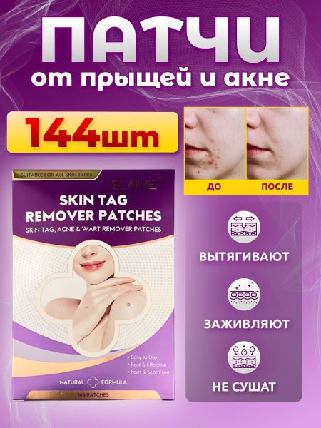 Прозрачные патчи-стикеры наклейки лечебные от прыщей, угрей и акне ...