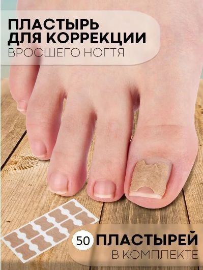 Пластырь от вросшего ногтя / Корректор от вросшего ногтя - купить с ...