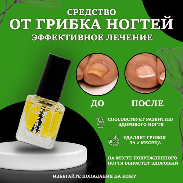Масло для ногтей средство для лечения грибка и онихолизиса, 5 мл ...