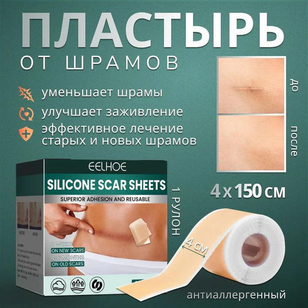 Пластырь силиконовый от шрамов 4х150 см. дерматикс Послеоперационный ...