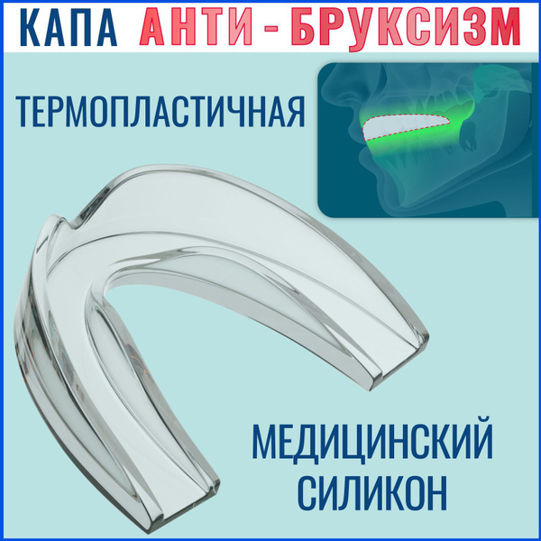 FFT / Капа стоматологическая от бруксизма для сна от скрежета зубами ...