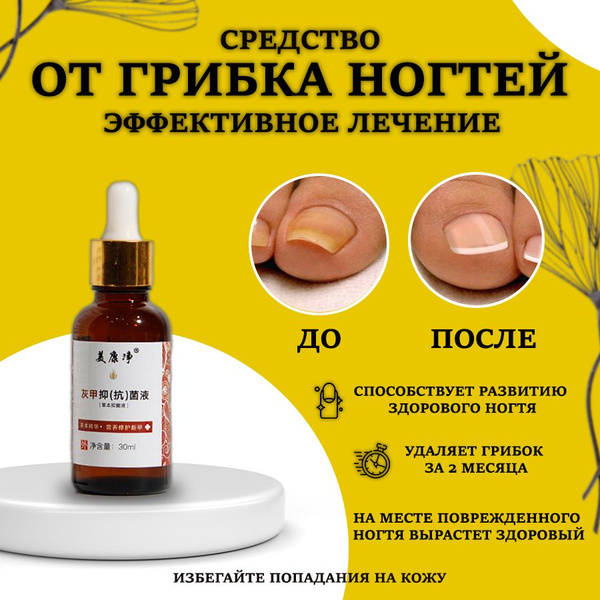 Масло для ногтей средство для лечения грибка и онихолизиса, 30мл купить ...