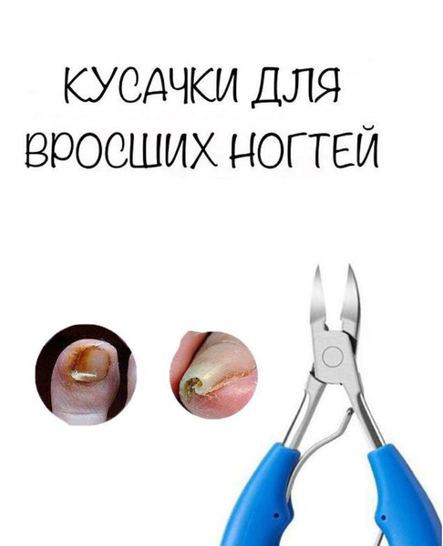 Набор инструментов для педикюра Кусачки дя вросшего ногтя педикюрные ...