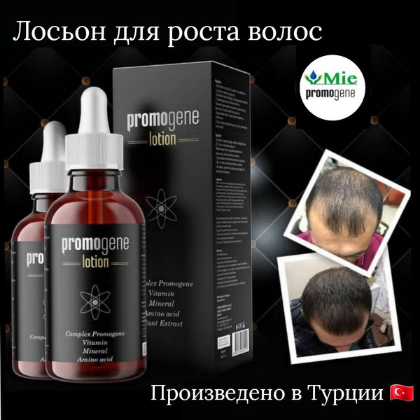 Mie Promogene Лосьон для волос, 60 мл - купить с доставкой по выгодным ...