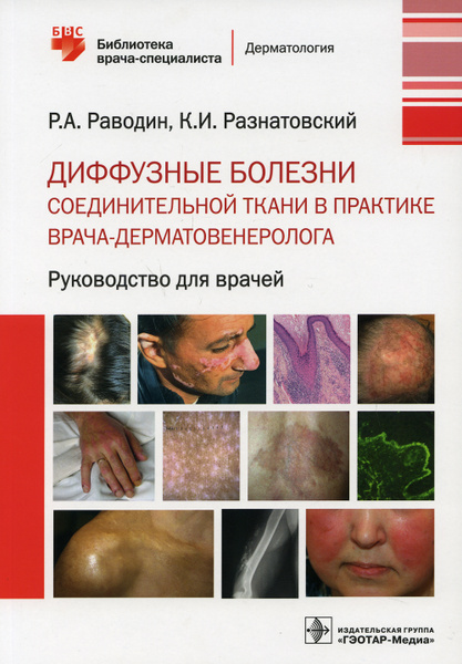 Диффузные болезни соединительной ткани в практике врача дерматовенеролога Библиотека врача