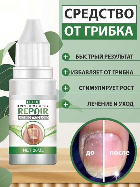 Средство для ногтей Elhoe ONYCHOMYCOSIS REPAIR от онихолизиса, от ...