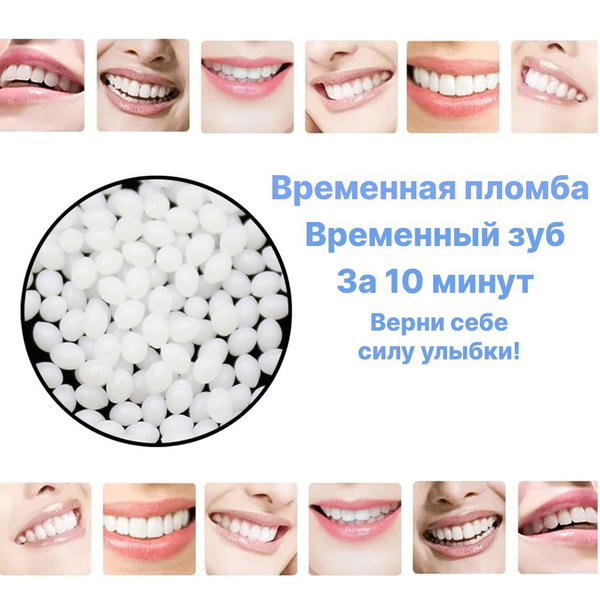 Временная пломба для зуба. Виниры для зубов накладные верхние и нижние ...