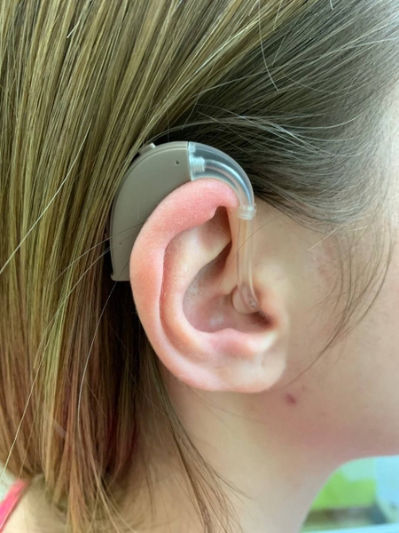 Цифровой слуховой аппарат Resound Key KE177 DW - купить с доставкой по ...