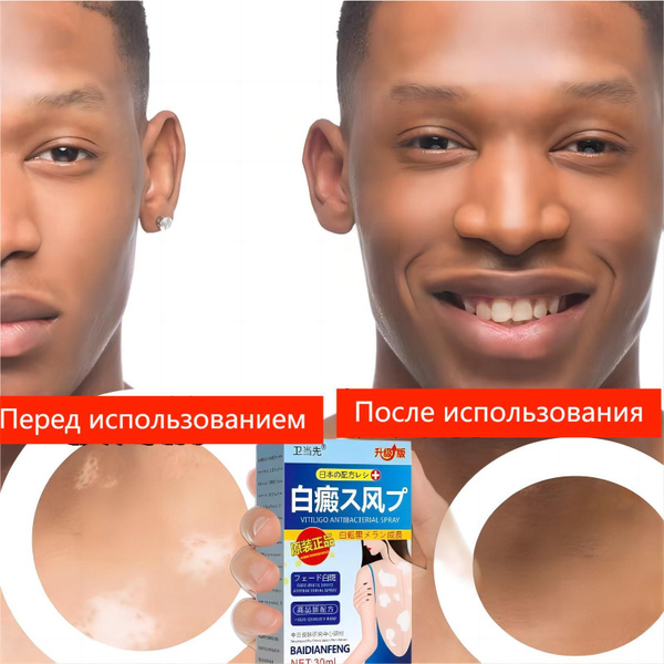 Увлажнитель для кожи pwjd - купить с доставкой по выгодным ценам в ...