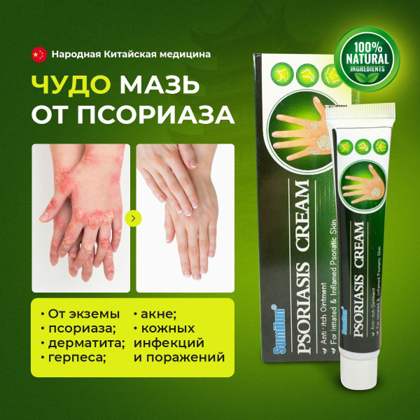 Мазь-крем от ПСОРИАЗА, экземы, атопического дерматита Sumifun ...