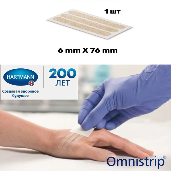 Пластырь-Стяжка Омнистрип (Omnistrip) гипоаллергенный стерильный 6х76мм ...
