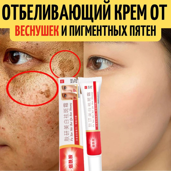 Отбеливающий крем от пигментных пятен на лице и руках купить с
