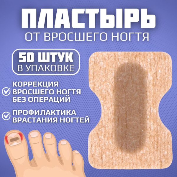 Наклейка пластырь - корректор от вросшего ногтя при врастании ногтевой ...