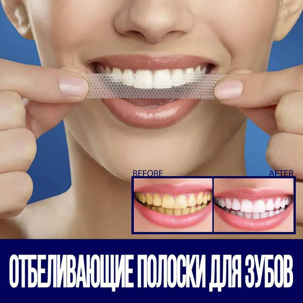 TiLe.home Отбеливающие полоски для зубов SEM9078 - купить с доставкой ...