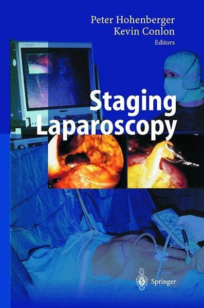 Staging Laparoscopy.2002 купить на OZON по низкой цене (849789587)