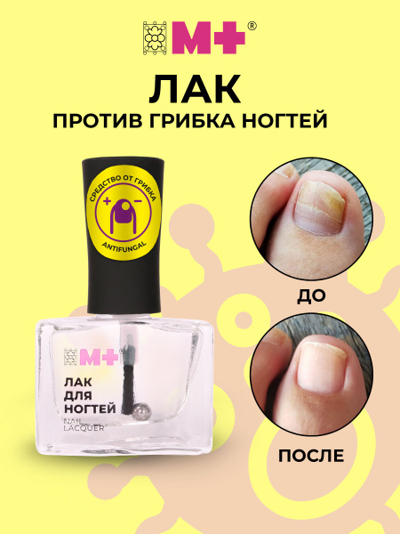 M+ Антифунгал Лак от грибка ногтей, средство для укрепления и роста ...