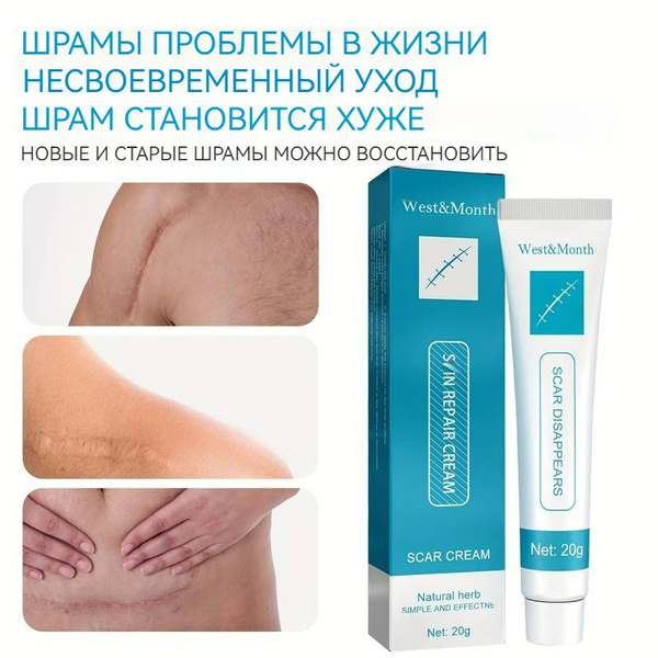 Травяной гель от шрамов от старых и новых рубцов - Эффективен при ...