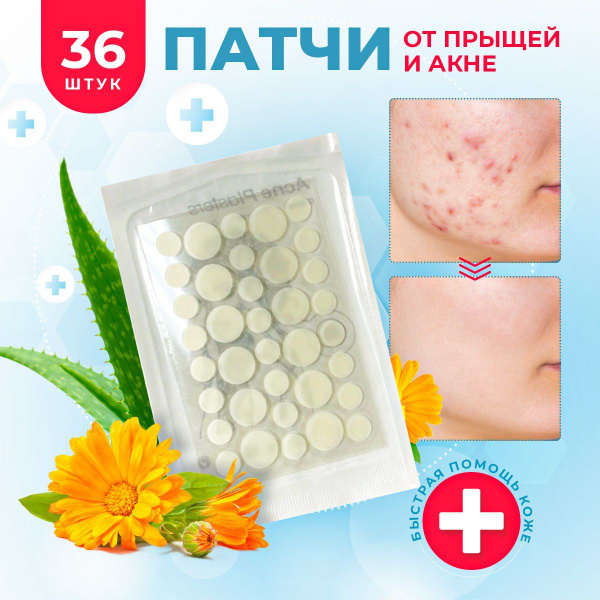 Патчи от прыщей Jomtam - купить с доставкой по выгодным ценам в ...