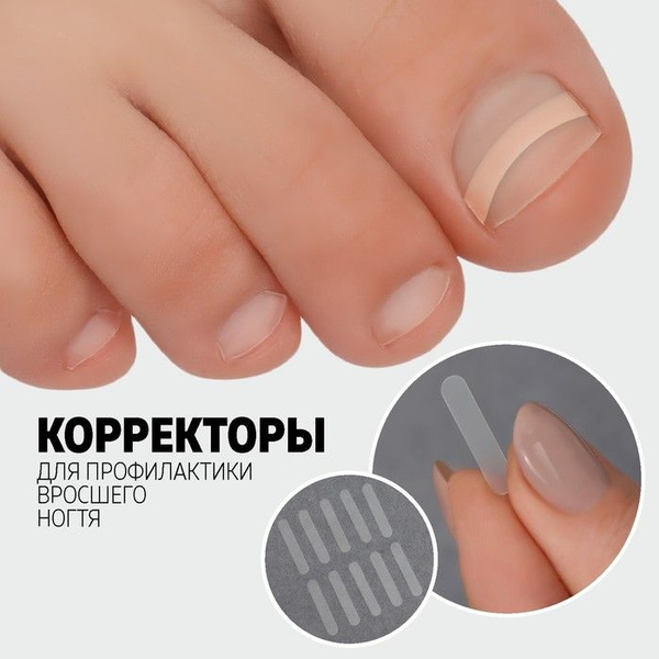 Корректор от вросшего ногтя Queen Fair sl-7367888-1-sl1272p1-188 ...