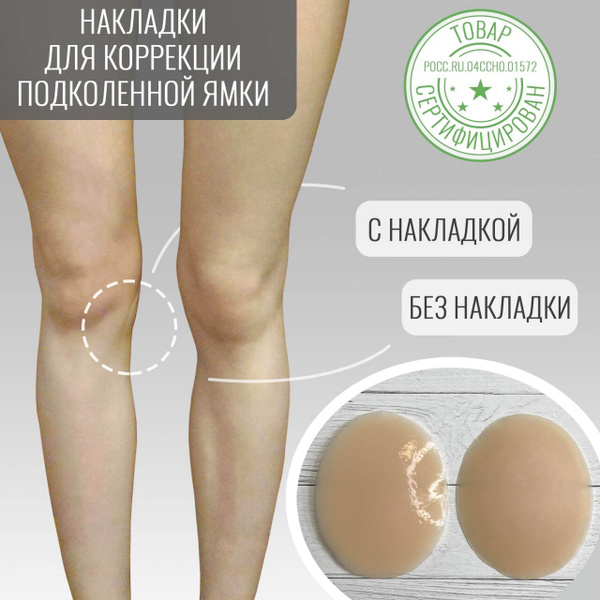 Силиконовые накладки для коррекции выраженного подколенного изгиба с внутренней стороны ноги ...