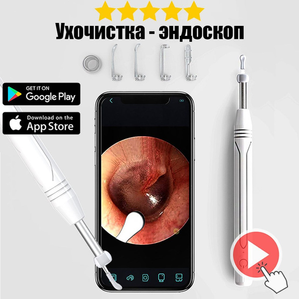 Вопросы и ответы о Эндоскоп ухочистка для смартфона, видеокамера ...
