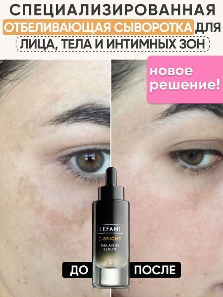 Сыворотка от пигментных пятен - купить с доставкой по выгодным ценам в ...
