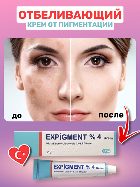 Expigment Turkey / ОТБЕЛИВАЮЩИЙ КРЕМ ДЛЯ ЛИЦА EXPIGMENT 4% / Крем от ...