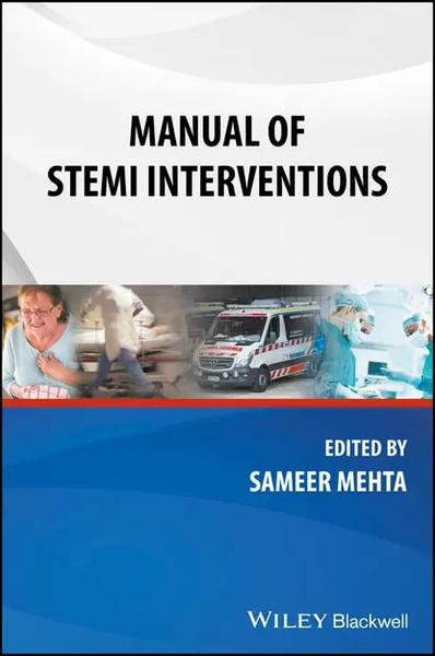 Manual Of Stemi Interventions Электронная книга купить с доставкой