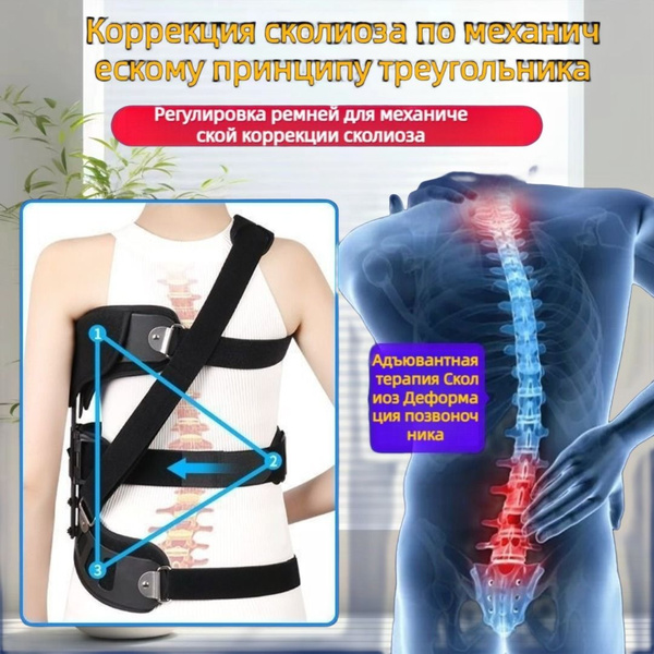 Характеристики Медицинский сколиозный фиксатор поясничного отдела ...