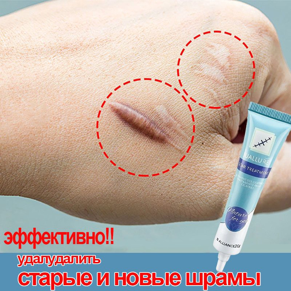 Крем для удаления шрамов , Гель от шрамов и, от постакне, против ...